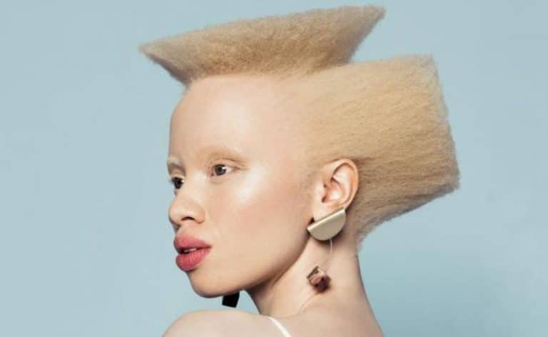 Thando Hopa, le mannequin albinos qui sublime le magazine Vogue ...