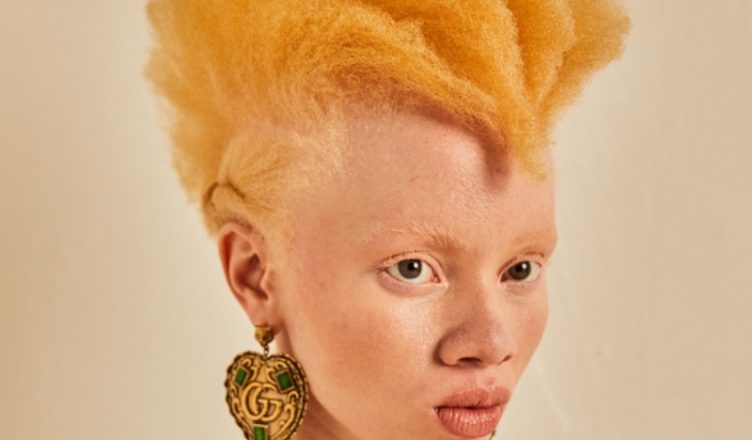 Thando Hopa, le mannequin albinos qui sublime le magazine Vogue ...