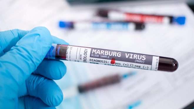 L’OMS tester le vaccin Marburg en Guinée équatoriale et Tanzanie